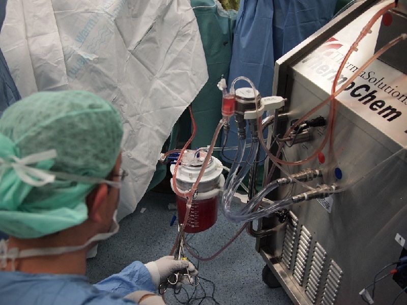 Hypertherme Intrathorakale Chemotherapie (HITHOC) | St. Georg